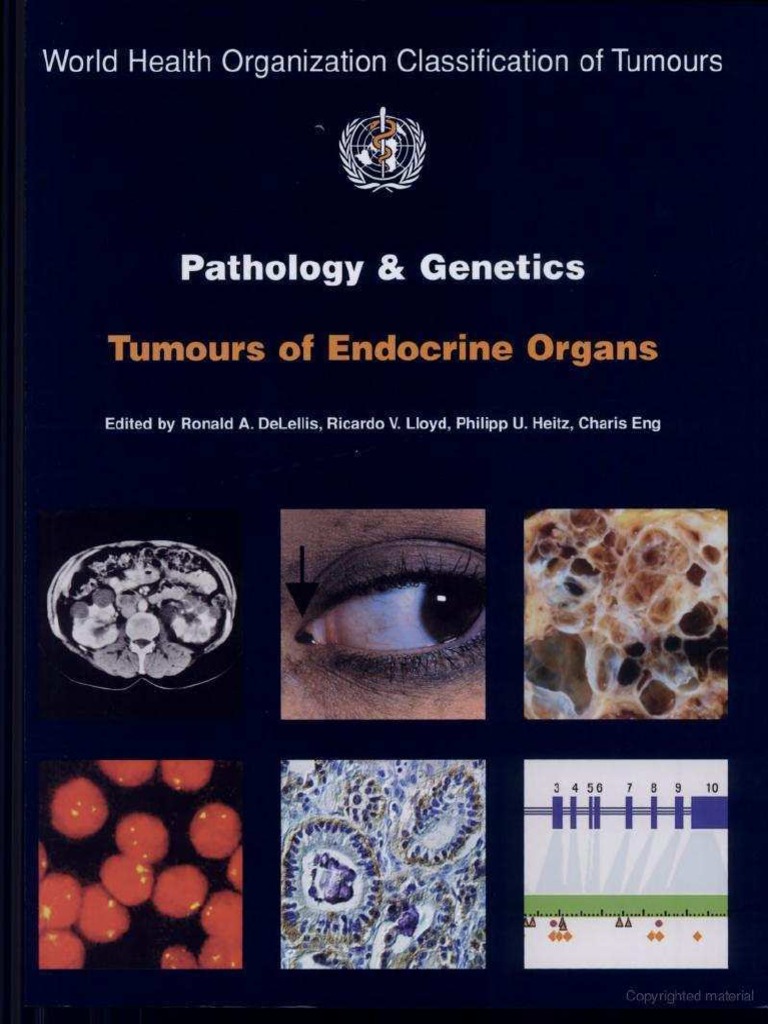 Pathology and Genetics of Tumours of Endocrine Organs.pdf