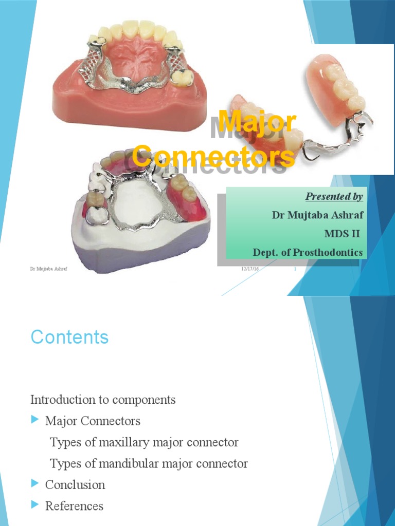 Major Connector in RDP | PDF | Dentures | Anatomical Terms Of Location