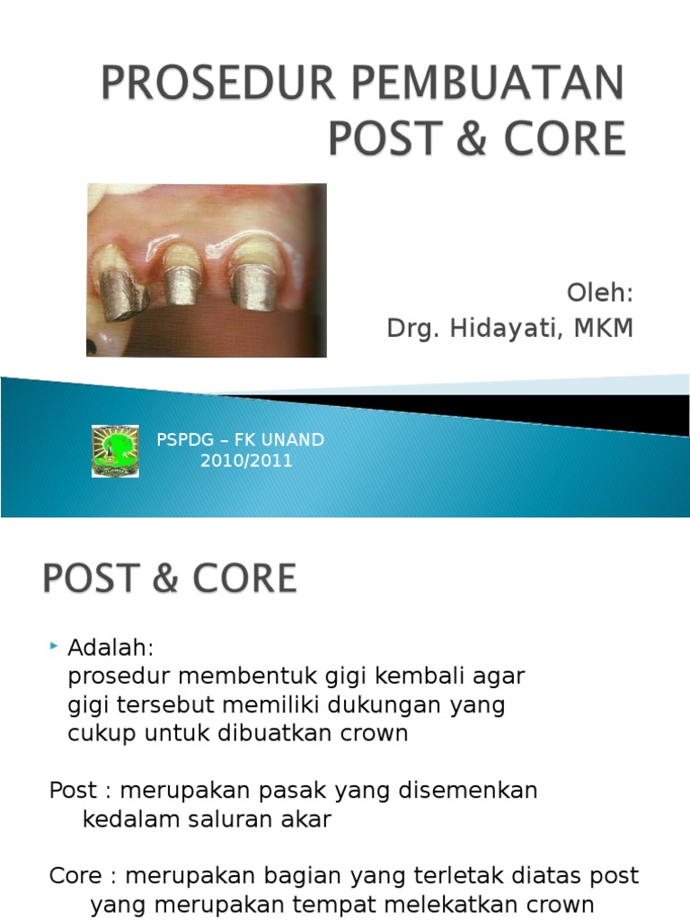Prosedur Pembuatan Post Core | PDF