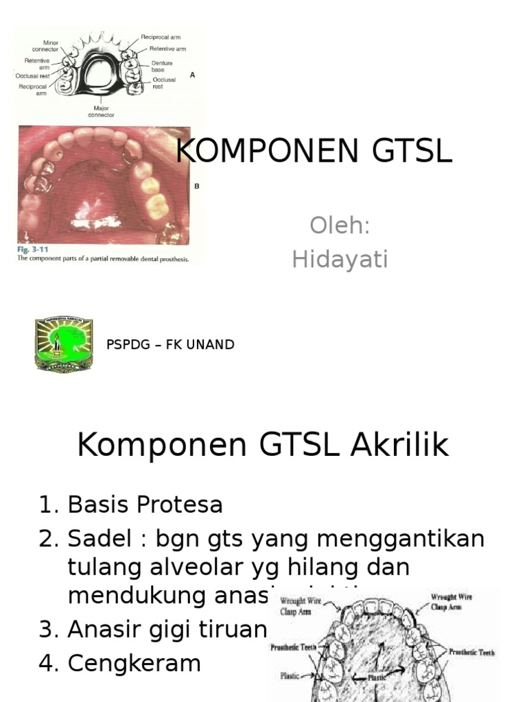 Komponen dan Desain GTSL Akrilik | PDF