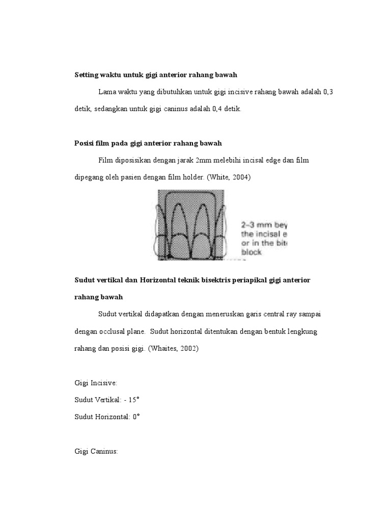 Posisi, Waktu & Sudut Radiografi Bisektris Periapikal RB | PDF