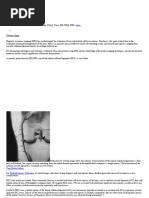 MRI Meniscus Tear Grading Guide | PDF