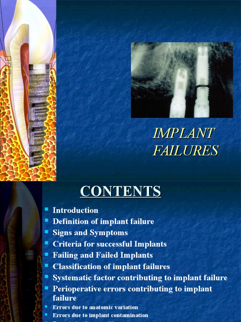 Understanding Implant Failures | PDF | Dental Implant | Torque