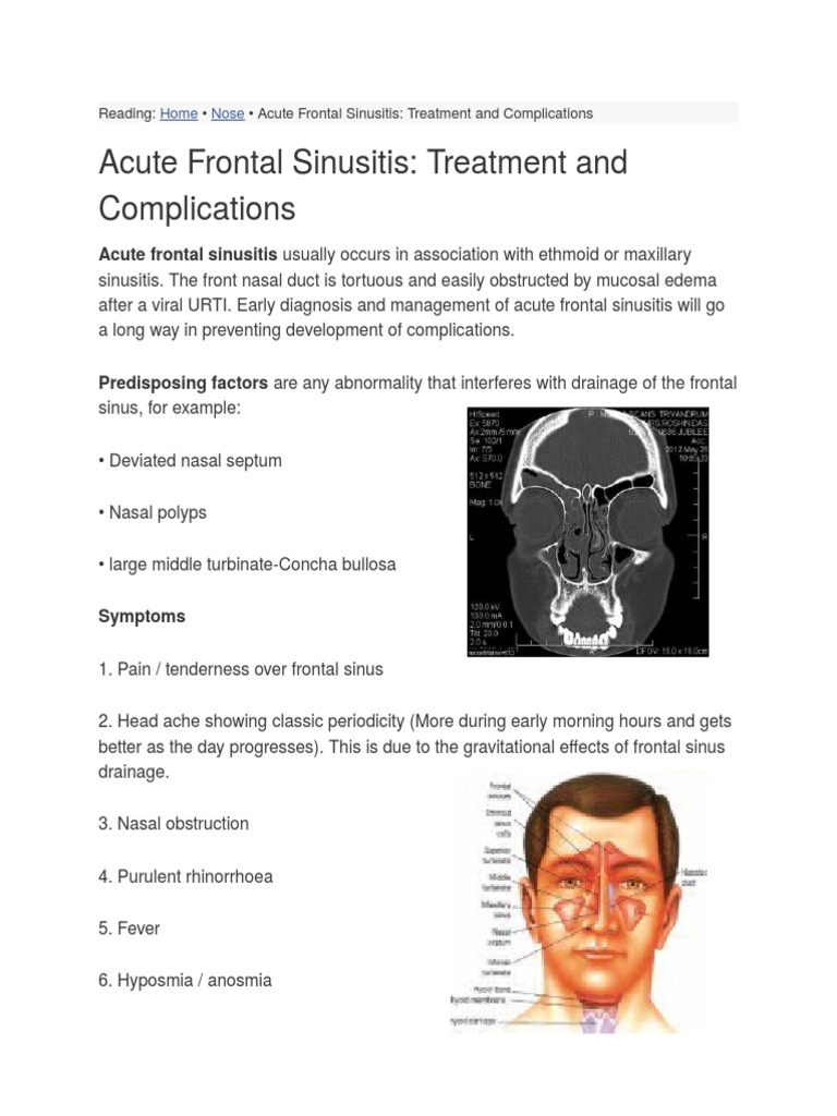 Acute Frontal Sinusitis: Treatment and Complications | PDF | Human Head ...