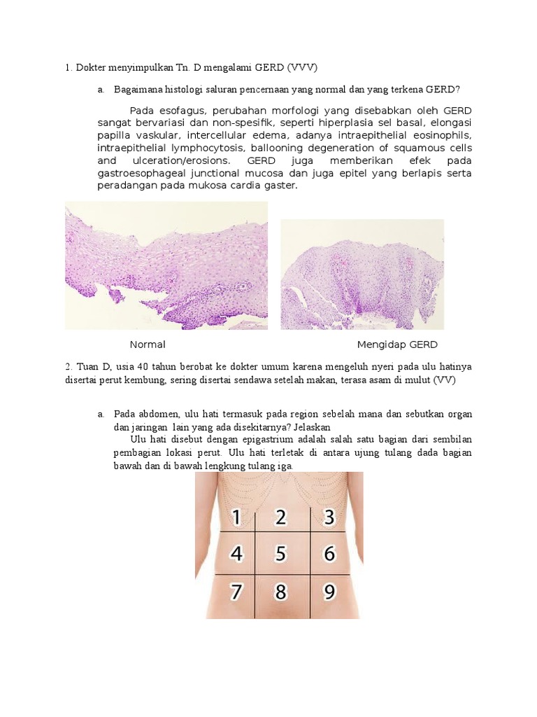 Analisis Masalah Anatomi Gaster Dan Esofagus | PDF