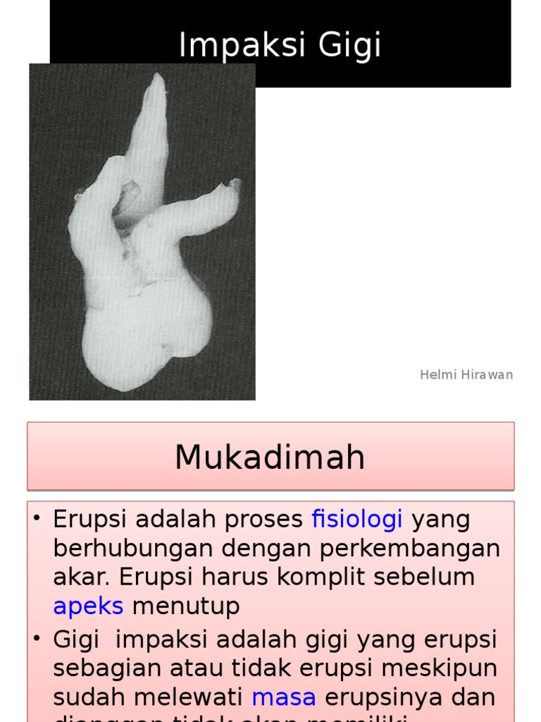 Impaksi Gigi | PDF