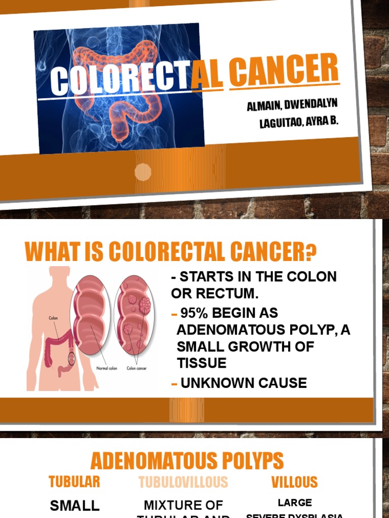 Colorectal Cancer | PDF | Colorectal Cancer | Cancer