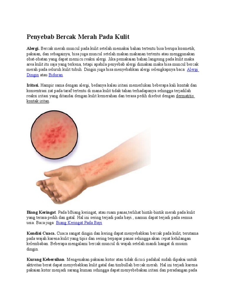 Penyebab Bercak Merah Pada Kulit | PDF