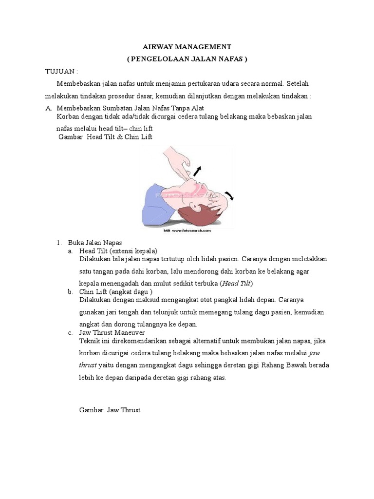 Airway Management | PDF