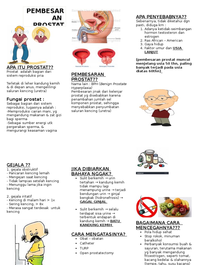 Leaflet BPH - Sheany | PDF