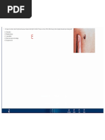 Step2Ck Nbme 8 Questions | PDF | Congenital Heart Defect | Human Anatomy