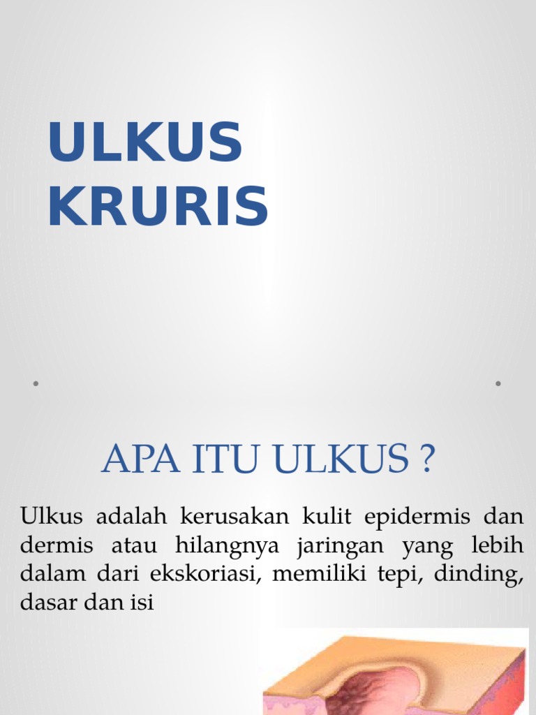 Ulkus Kruris: Penyebab, Gejala, Diagnosis, dan Pengobatan Berbagai ...