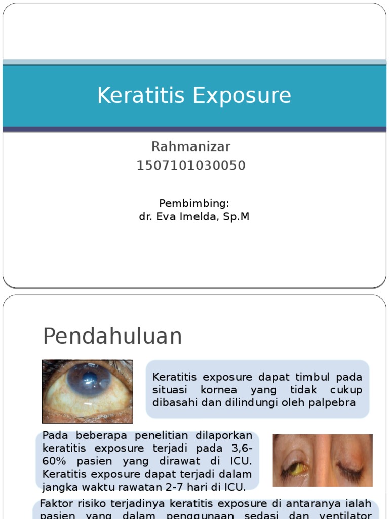Keratitis Exposure | PDF