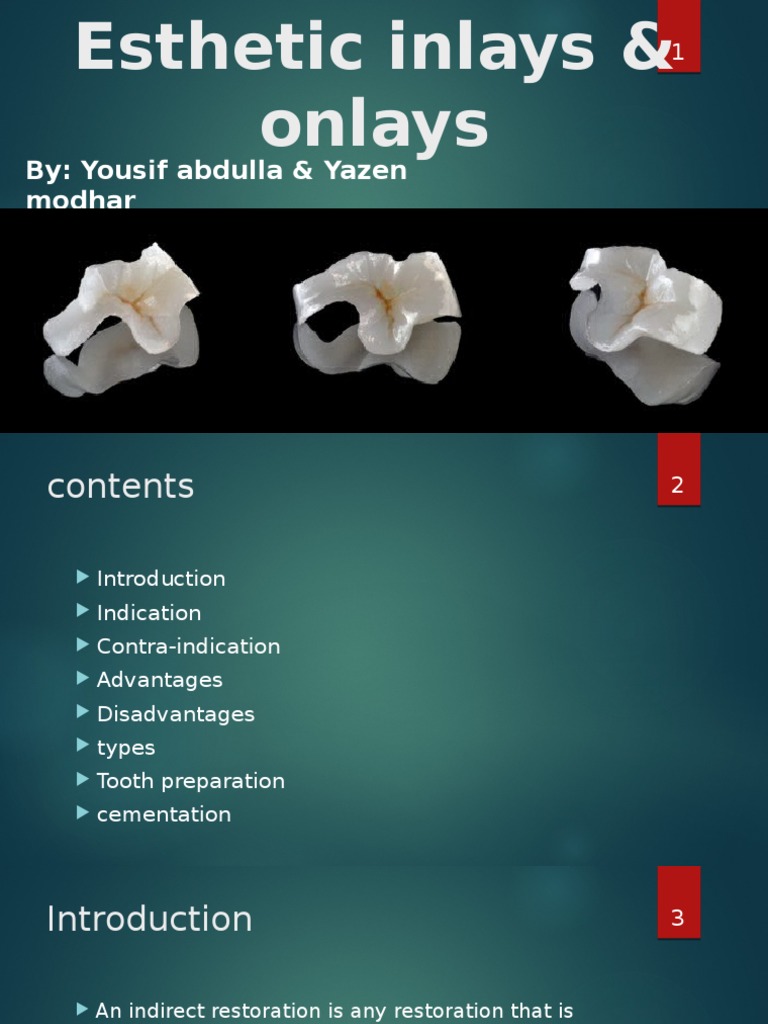 Esthetic Inlays & Onlays | Download Free PDF | Dental Composite | Mouth