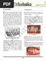 Edge to Edge Occlusion Overview | PDF | Orthodontics | Dental Anatomy