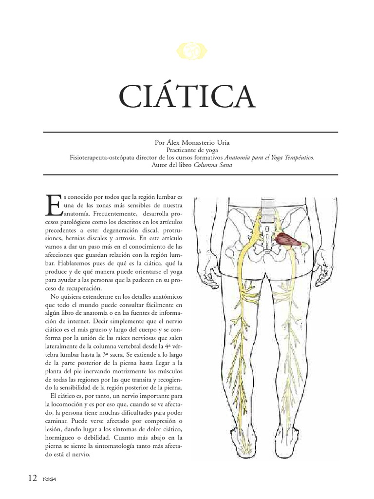 Ciatica PDF | PDF | Sistema musculoesquelético | Anatomía humana