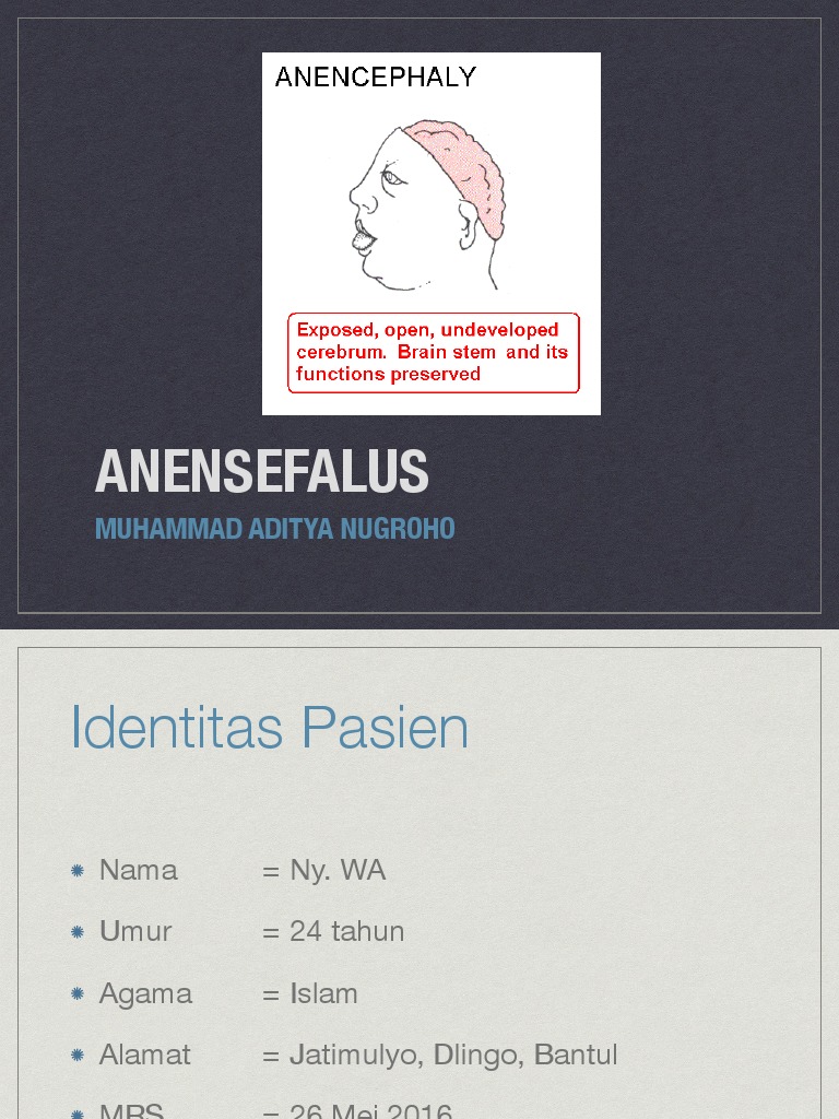 Anencephaly | PDF