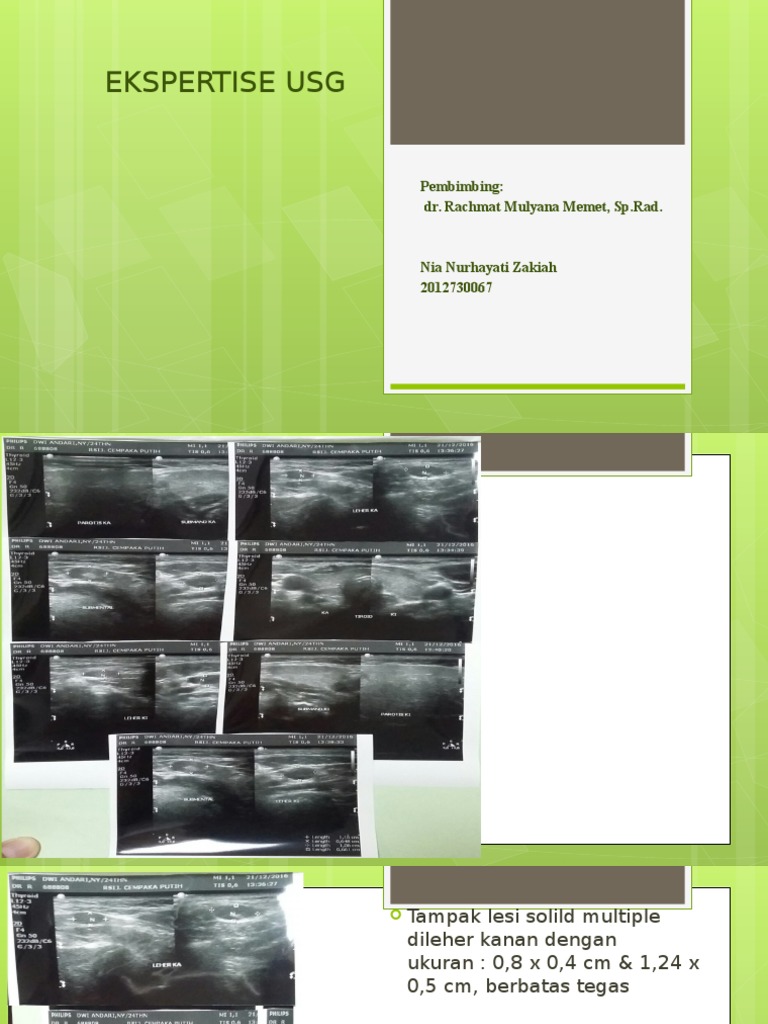 Limfadenopati Leher: Penyebab & Gejala | PDF