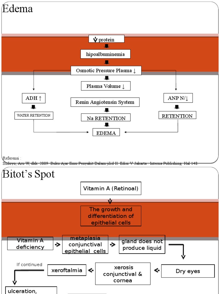 Patomekanisme Edema Dan Bitot's Spot | PDF