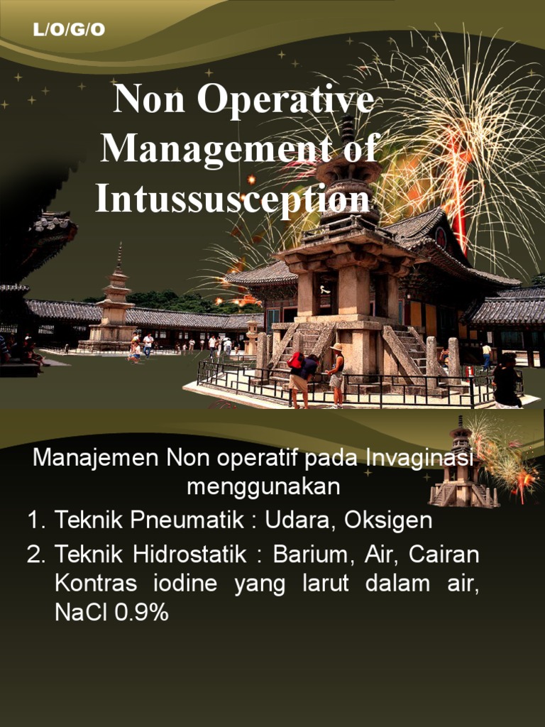 Non-Operative Intussusception Management | PDF