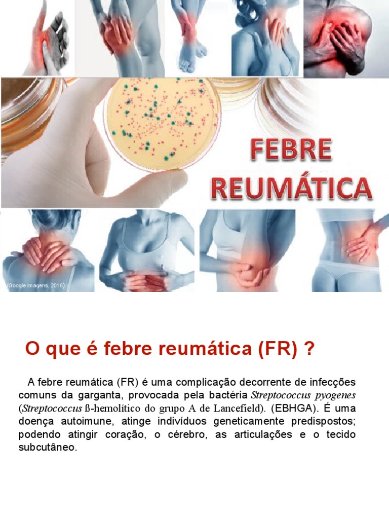 Febre Reumática - Microbiologia | Streptococcus | Saúde pública