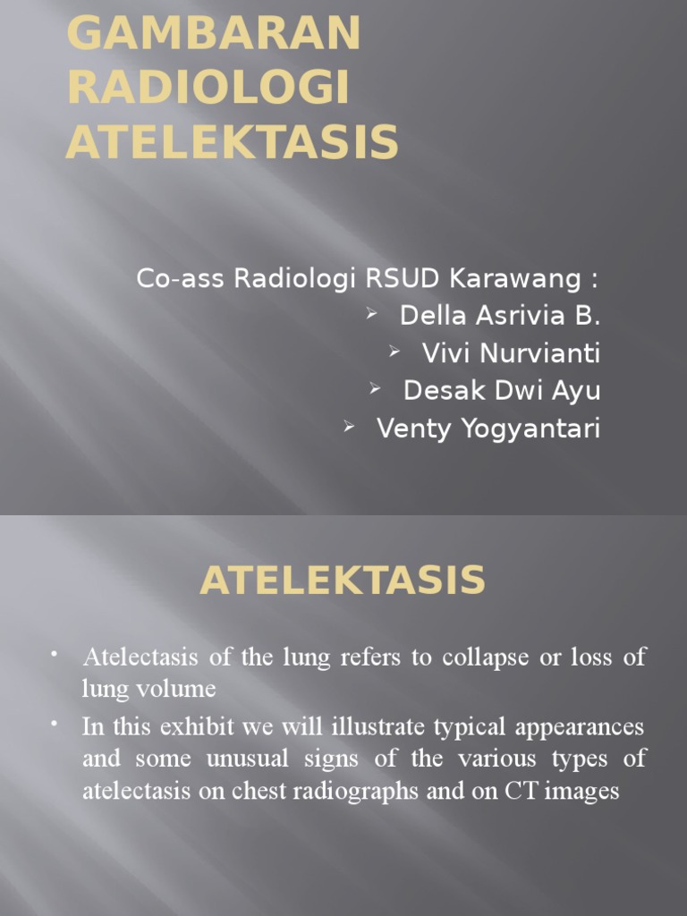 Radiologic Findings of Atelectasis | PDF | Lung | Radiology
