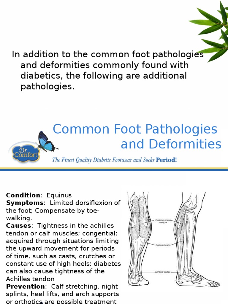 CFTS-Common Foot Pathologies | PDF