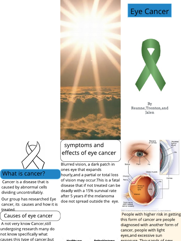 Understanding Eye Cancer: Causes & Risks | PDF