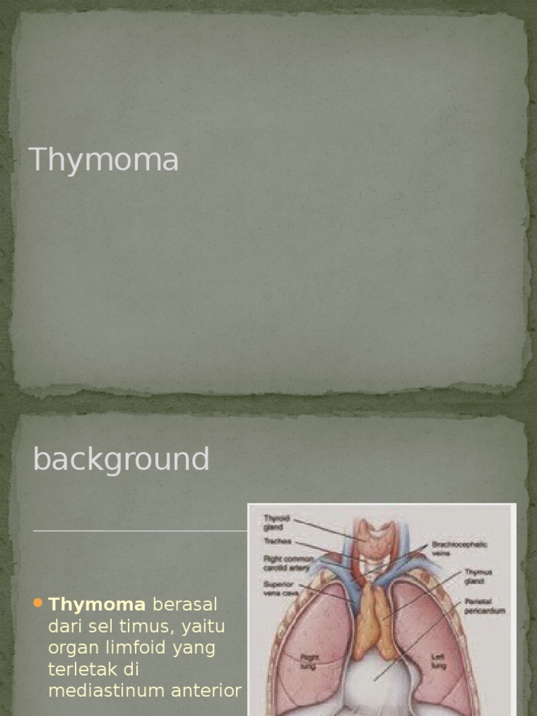 CL Thymoma | PDF | Pengembangan Diri | Kesehatan Holistik