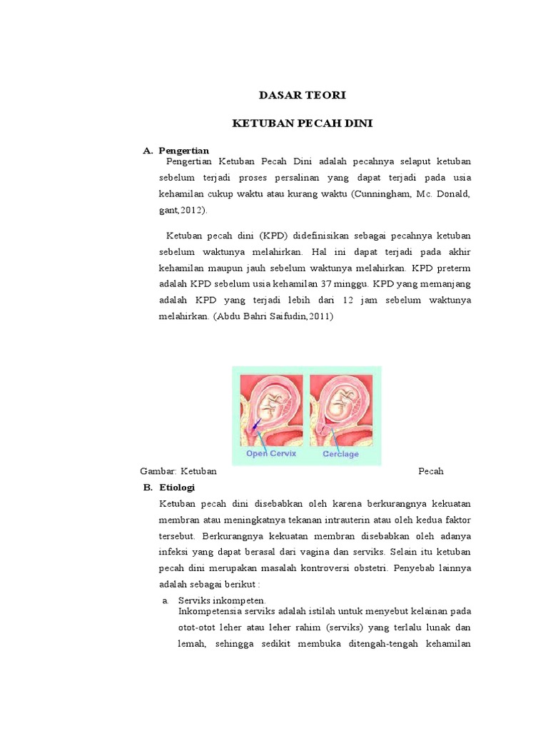Dasar Teori KPD | PDF