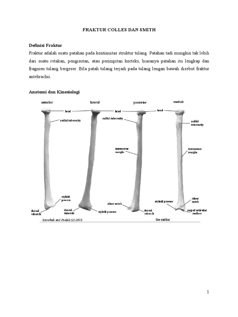 Tinjauan Pustaka Fraktur Colles Dan Smith | PDF