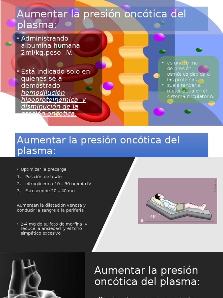 Aumentar La Presión Oncótica Del Plasma | Descargar gratis PDF | Edema ...