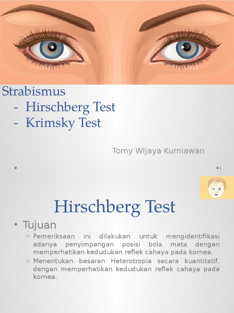 Strabismus | PDF