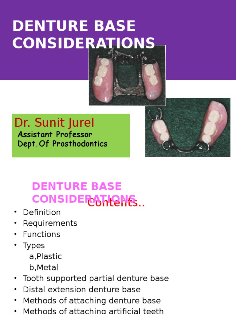 Denture Base Consideration-16!12!14 | PDF | Dentures | Mouth