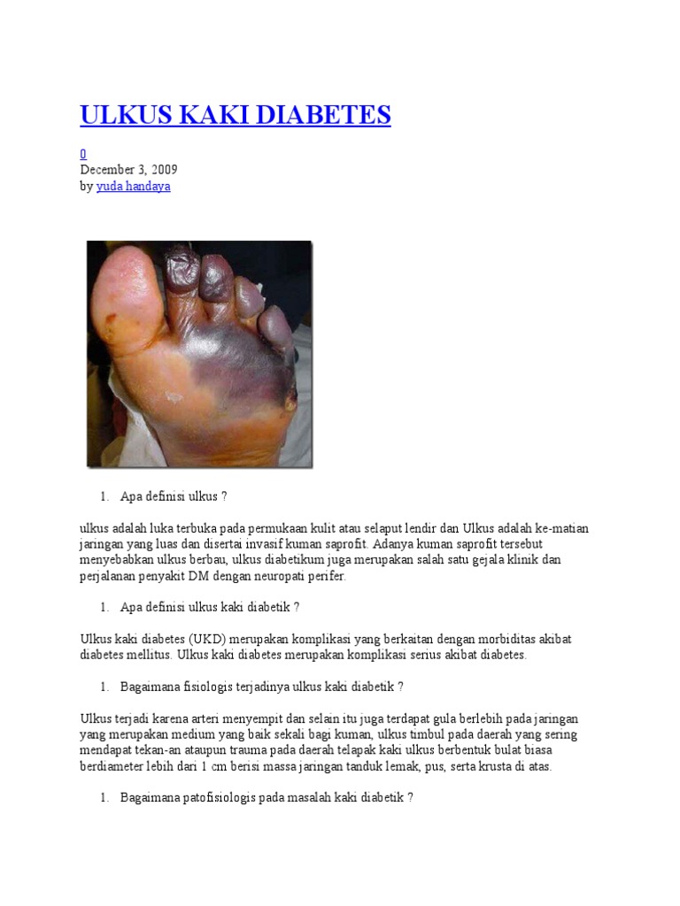 Ulkus Kaki Diabetes | PDF