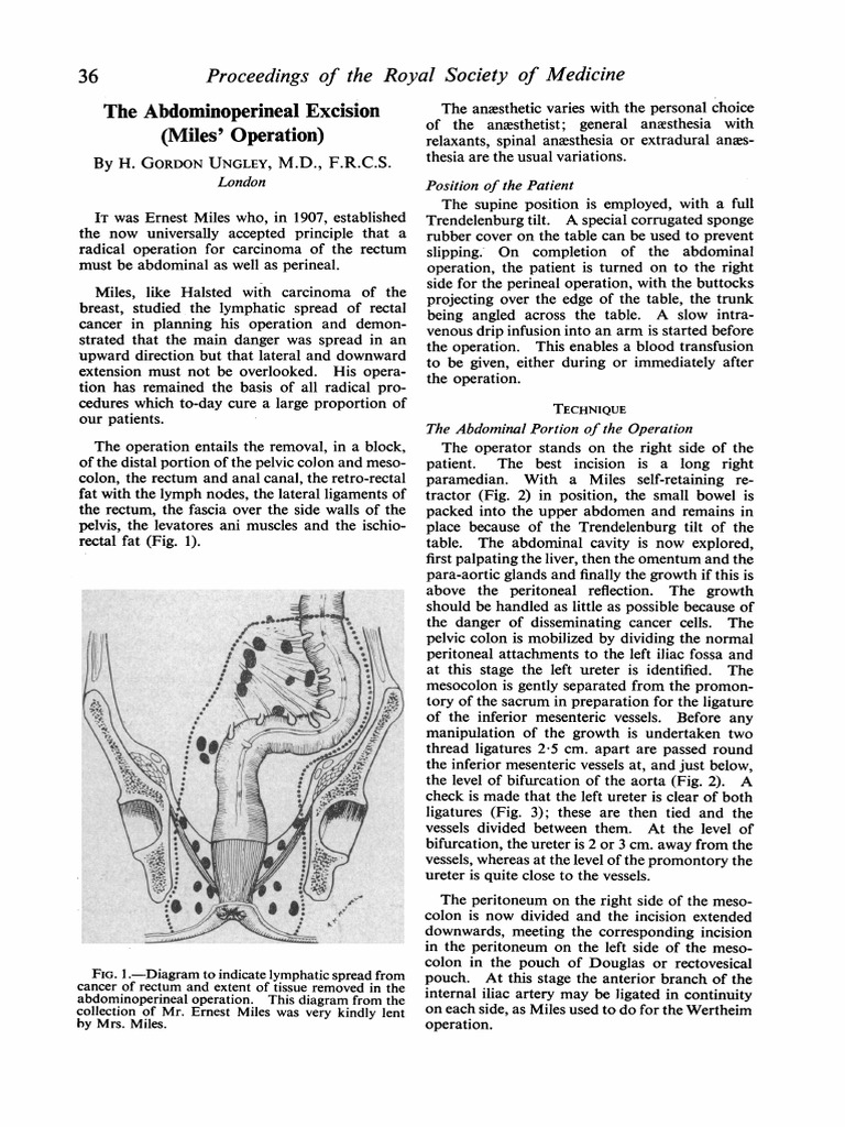 Miles Operation - Abdominoperineal Excision - Rectal CA | PDF | Pelvis ...