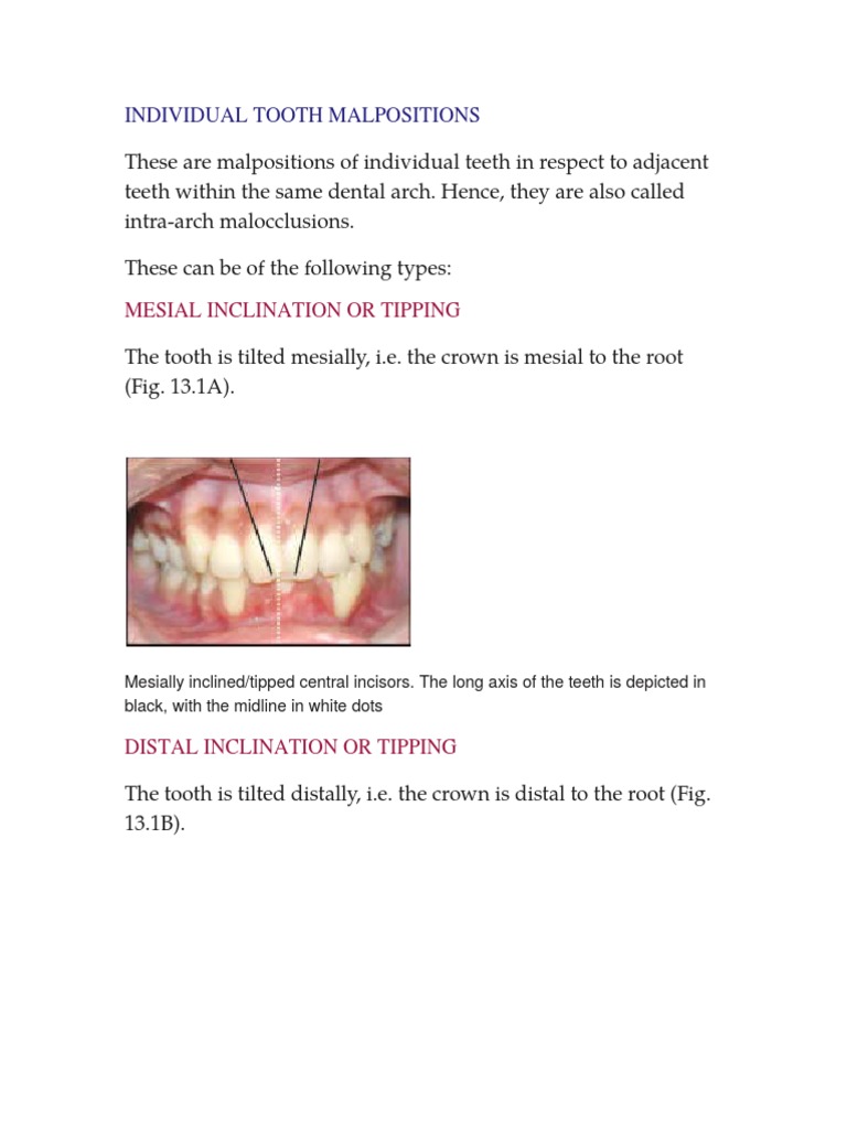 Individual Tooth Malpositions | PDF