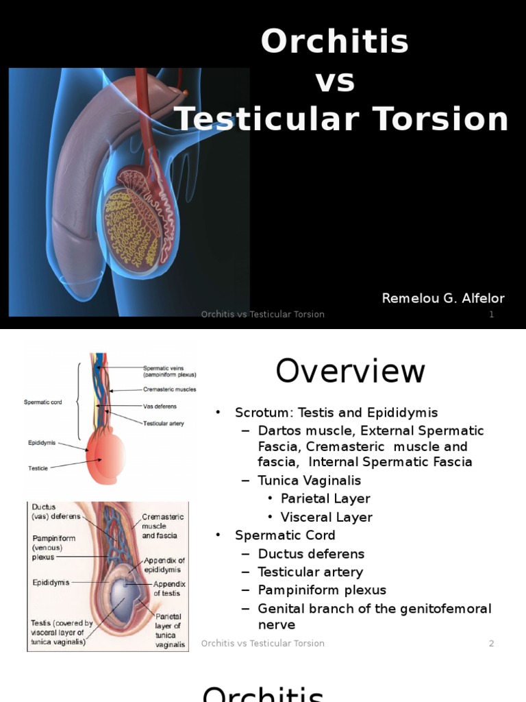 Orchitis Vs Testicular Torsion Urology Report Pdf Medical