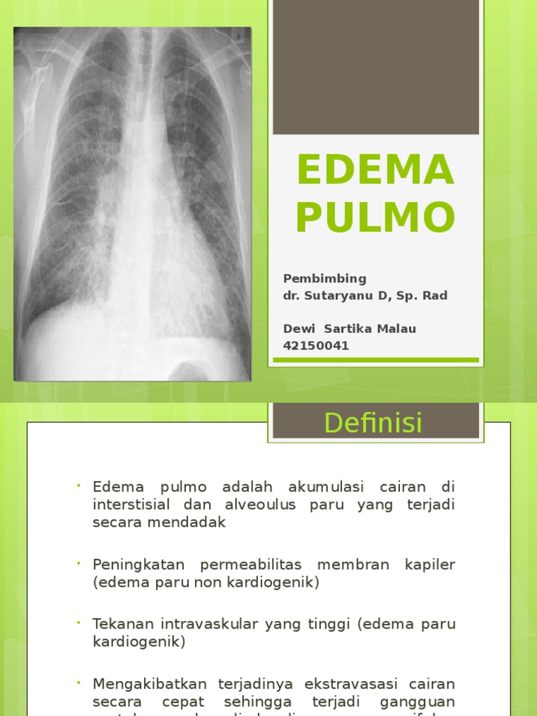 Edema Pulmo | PDF