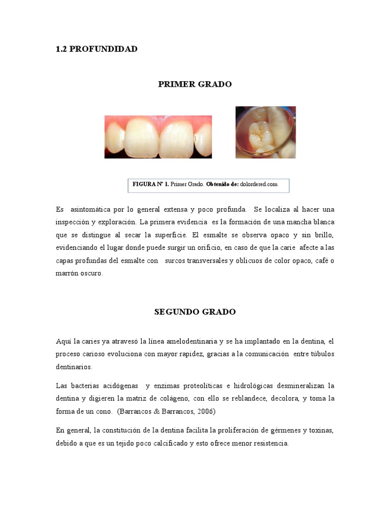 Clasificación de Caries Dentales por Grados | PDF | Diente humano ...