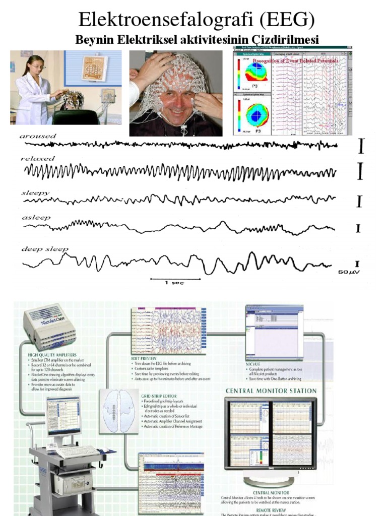 Eeg | PDF