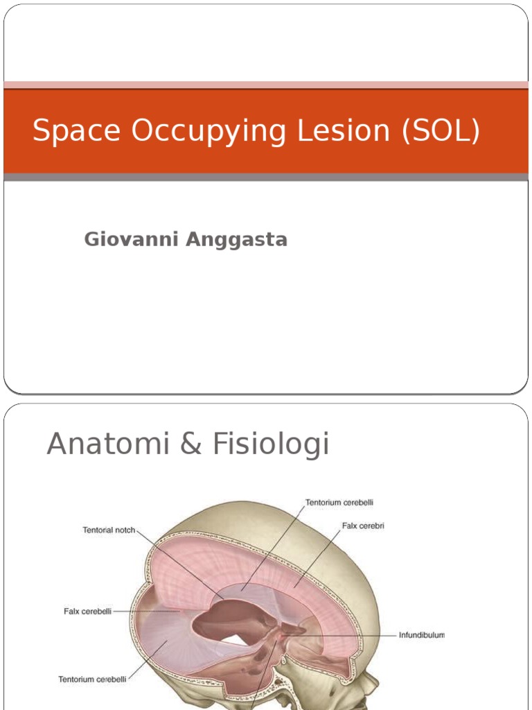 SOL Gejala dan Diagnosis | PDF