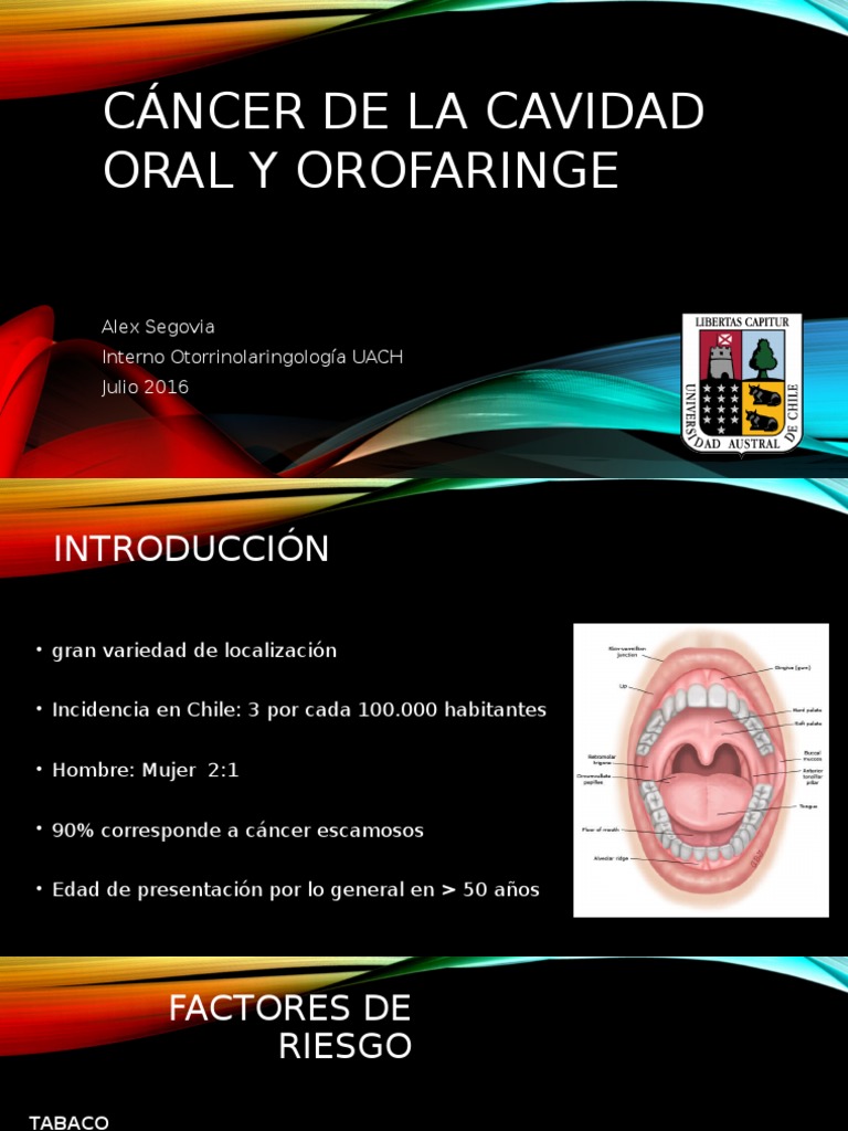 Cáncer de Cavidad Oral y Orofaringe 2016 | Metástasis | Cáncer de pulmón