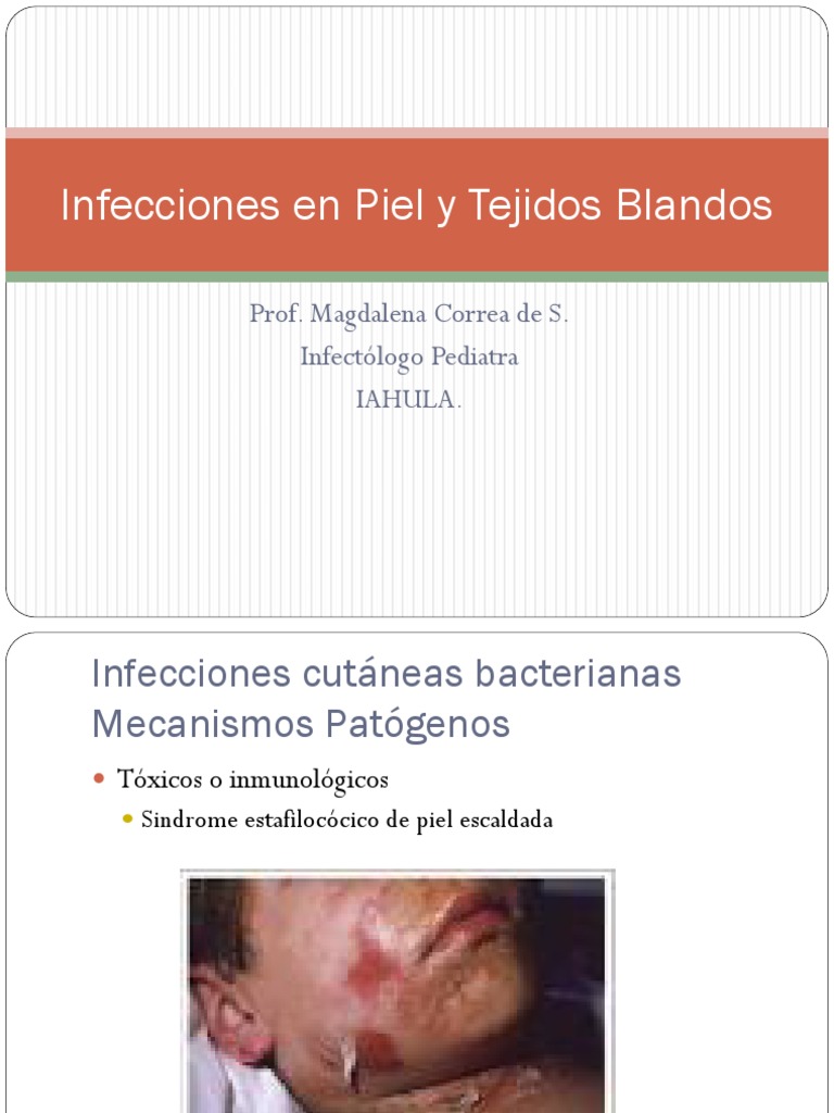 Infecciones en Piel y Tejidos Blandos (D) | PDF | Condiciones cutáneas | Enfermedades y trastornos