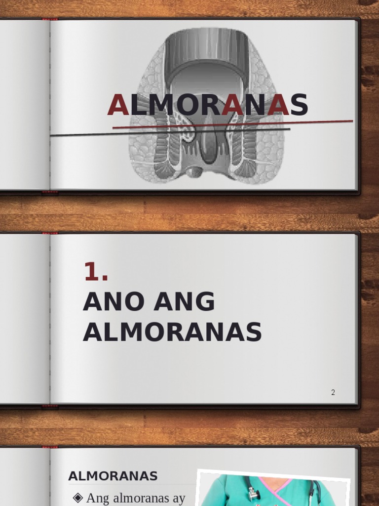 Almoranas | PDF