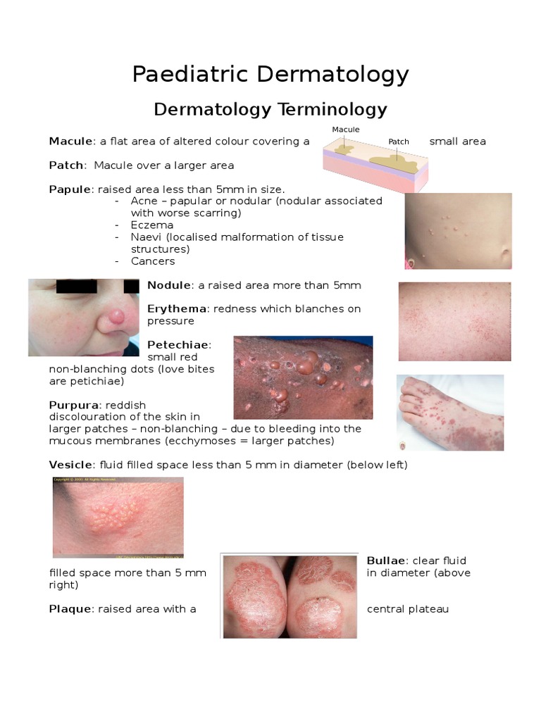 Paediatric Dermatology | PDF | Dermatitis | Psoriasis