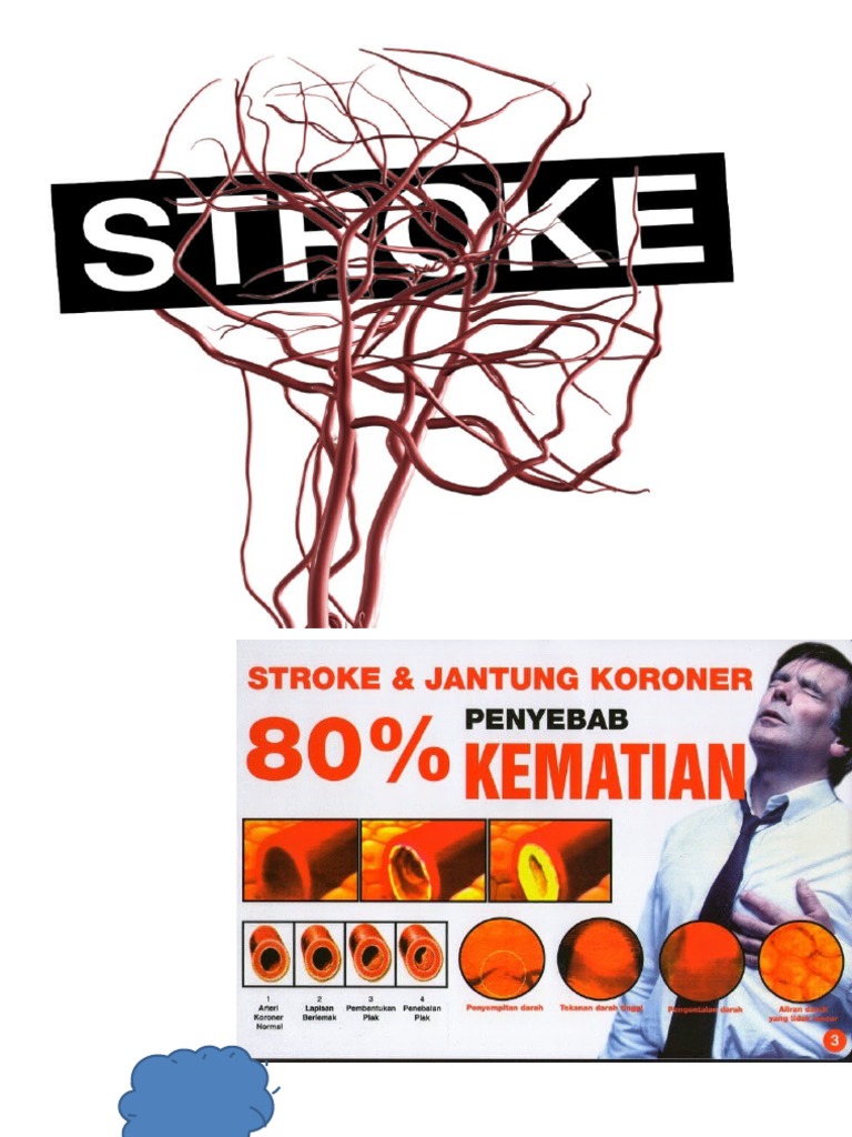 Penyuluhan Stroke | PDF