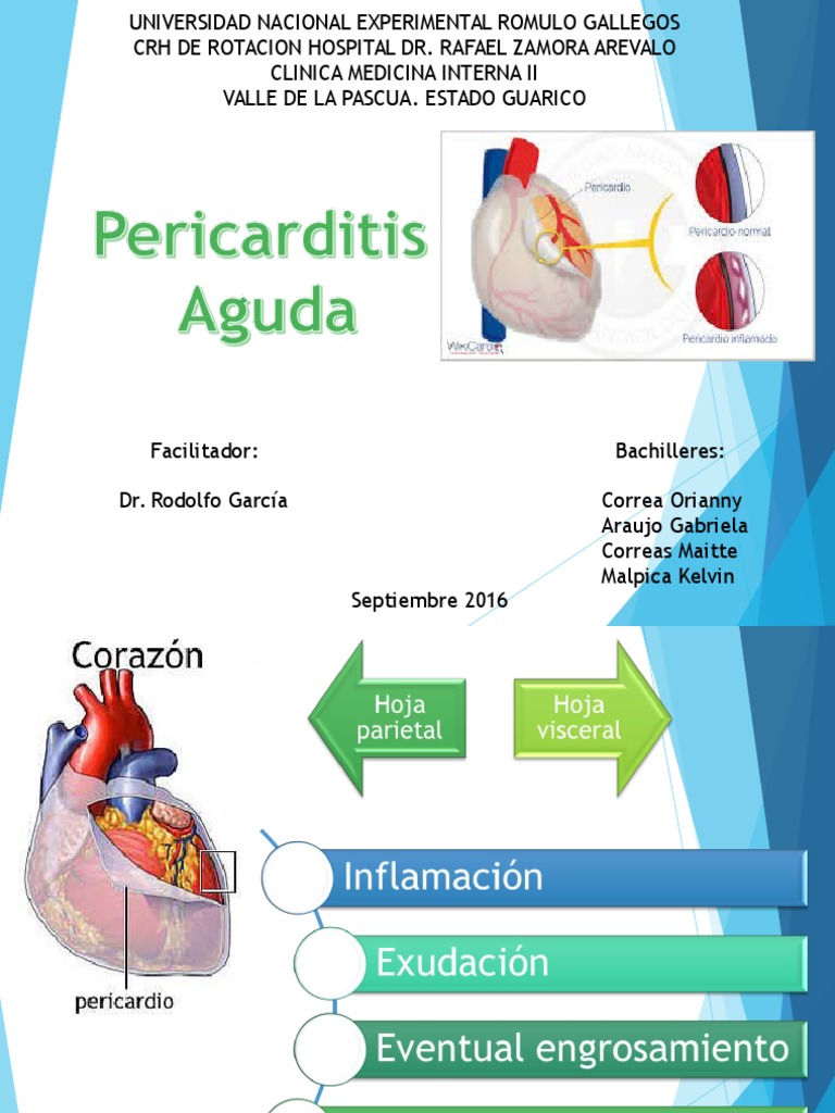 Pericarditis | Electrocardiografia | Medicina Interna