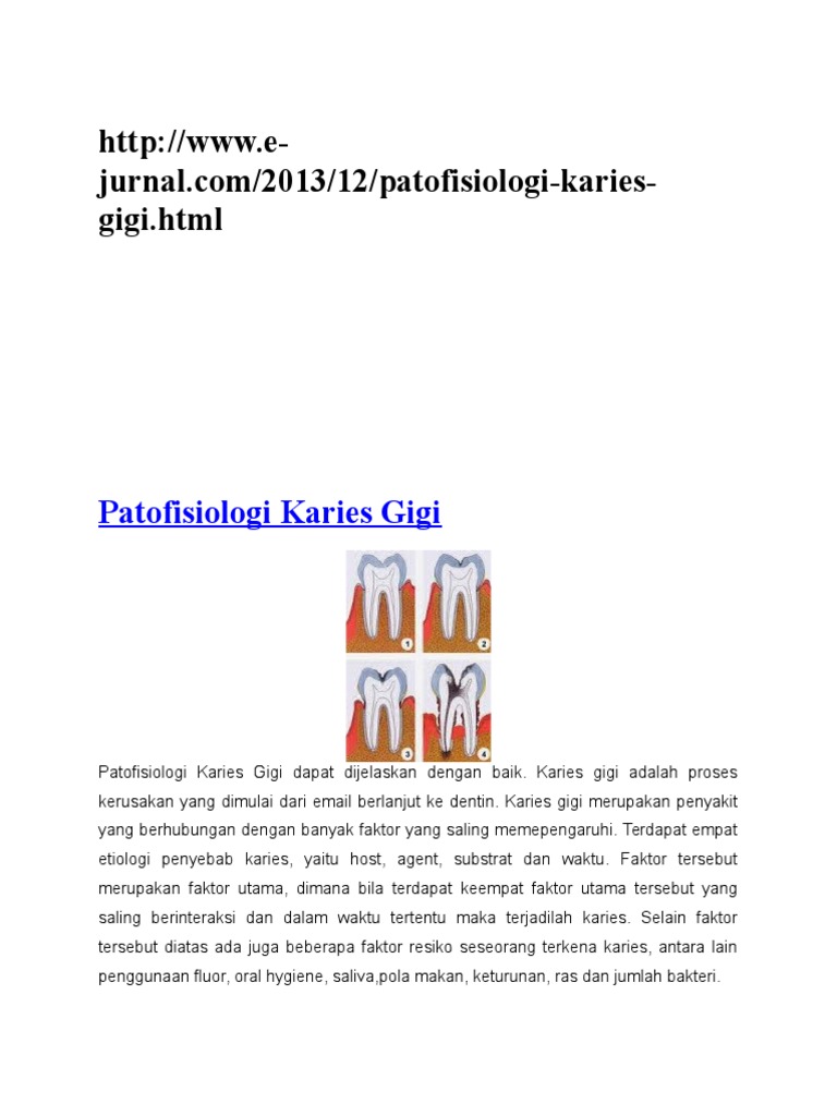 Caries Patofisiologi Karies Gigi | PDF