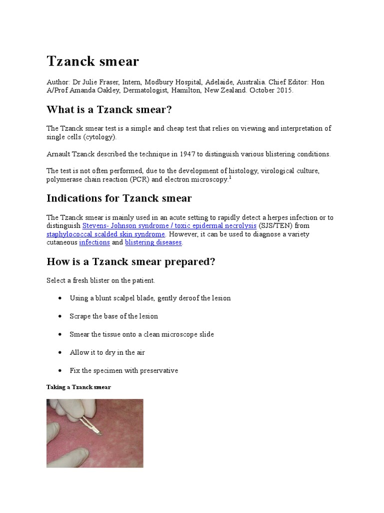 Tzanck Smear | Staining | Cytopathology